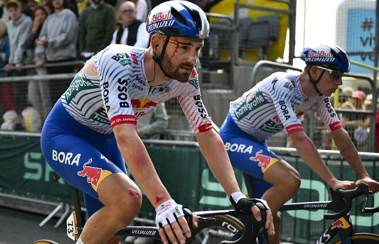 Why are cyclists able to endure more pain than other athletes?